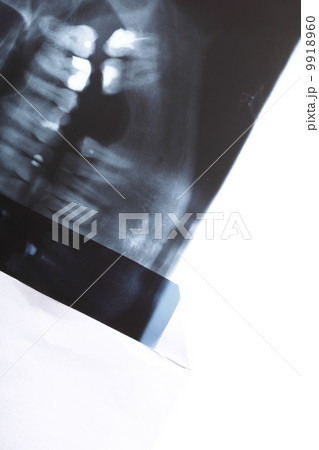 X-ray scan of humans teethの写真素材 [9918960] - PIXTA