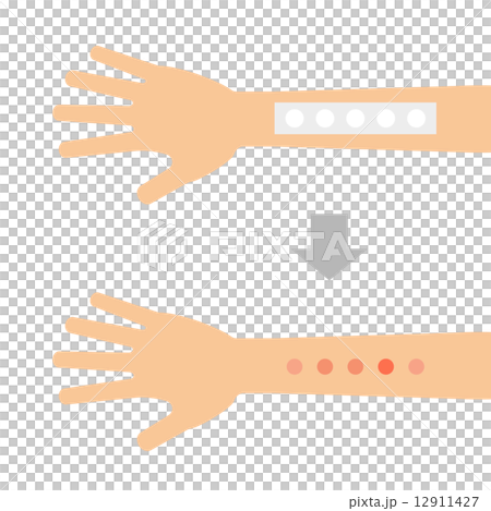 Patch test - Stock Illustration [12911427] - PIXTA