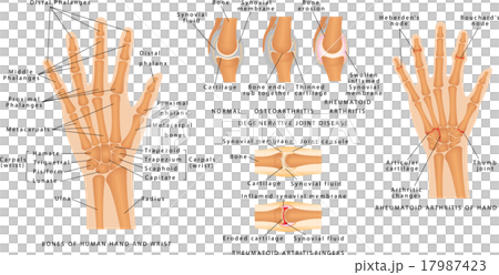 Skeletal System Phalanges - Stock Illustration [17987423] - PIXTA