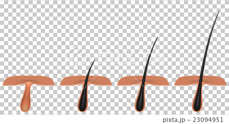 Hair root section - Stock Illustration [23094951] - PIXTA