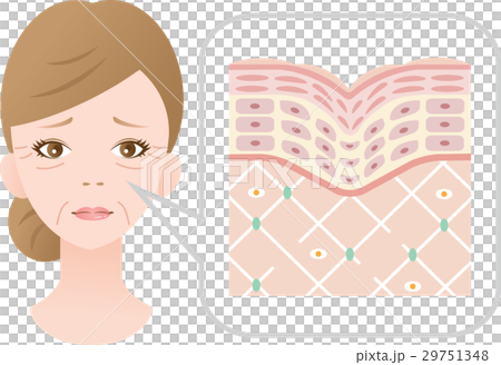 Wrinkle skin cross section - Stock Illustration [29751348] - PIXTA