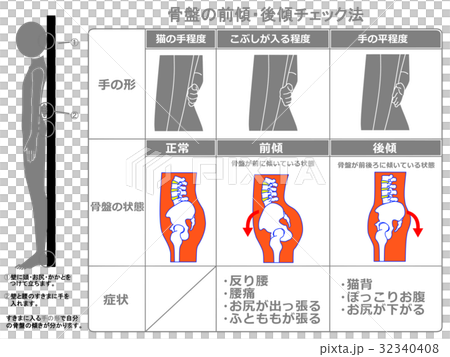 Front anteversion / posterior inclination check... - Stock Illustration ...