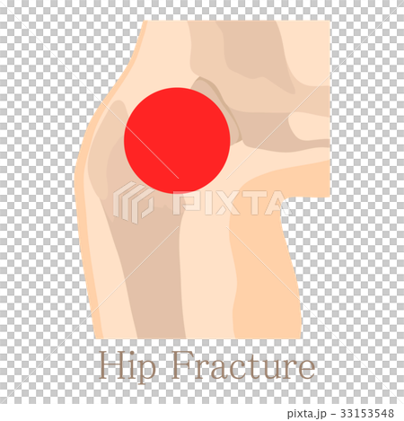 Hip fracture icon, cartoon style - Stock Illustration [33153548] - PIXTA