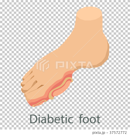 Diabetic foot icon, isometric style-插圖素材 [37572772] - PIXTA圖庫