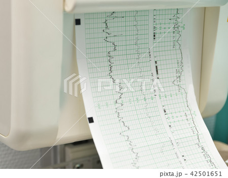 Monitor for measuring contractions, heartbeat...の写真素材 [42501651] - PIXTA