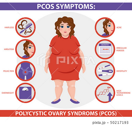 PCOS Symptoms infographic. Women Health.のイラスト素材 [50217193] - PIXTA