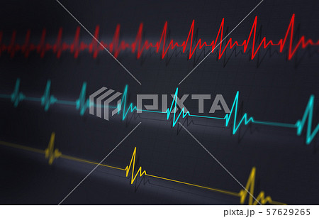 Fast Normal Slow Heartbeat ecgのイラスト素材 [57629265] - PIXTA