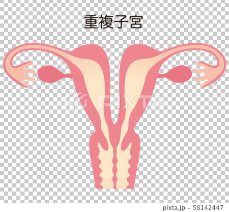 Uterine malformation Duplicate uterus - Stock Illustration [58142447 ...