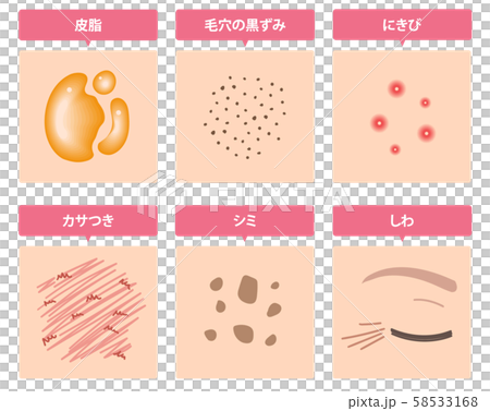 Skin trouble Sebum Pore Stain Acne Wrinkles Set - Stock Illustration ...