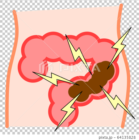 constipation - Stock Illustration [64135828] - PIXTA