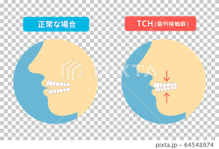 Teeth wear and TCH stress temporomandibular... - Stock Illustration ...