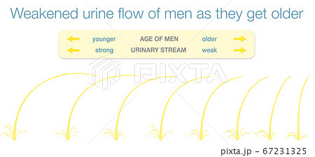 Weakened urinary flow of men as they get older....のイラスト素材 [67231325 ...