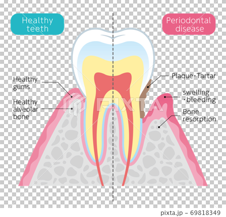 tine, cross-section diagram, vector - Stock Illustration [69818349] - PIXTA
