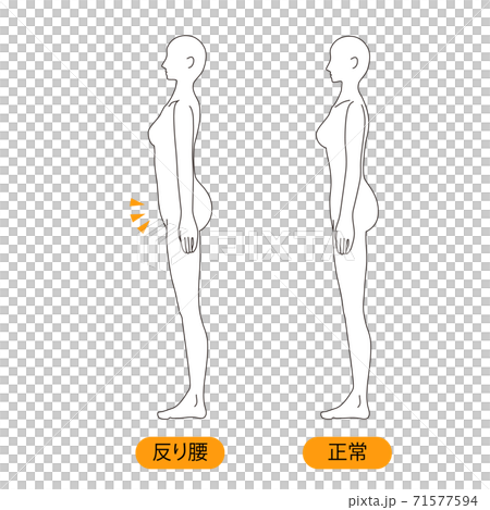 Female medical posture (warped waist) beauty... - Stock Illustration ...