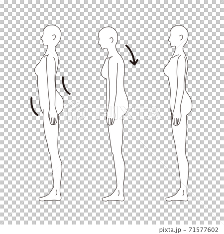 Female medical posture (warped waist, stoop)... - Stock Illustration ...