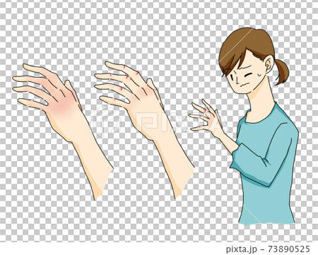 Rough hands, a painful woman - Stock Illustration [73890525] - PIXTA