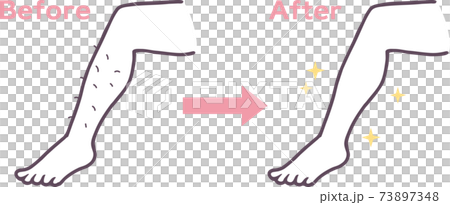 Before and after illustration material of... - Stock Illustration ...