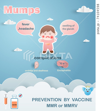 Infographics Mumps virus.The kid boy sick...のイラスト素材 [74104598] - PIXTA