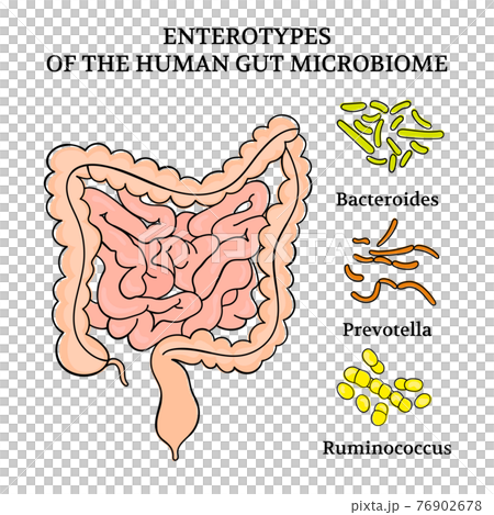 ENTEROTYPES OF THE HUMAN GUT MICROBIOME... - Stock Illustration [76902678] - PIXTA
