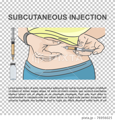 SUBCUTANEOUS INJECTION Into Abdomen Syringe In... - Stock Illustration ...