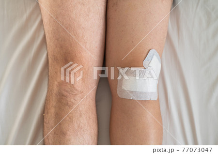 Close-up of male legs with knee taped with tape...の写真素材 [77073047] - PIXTA