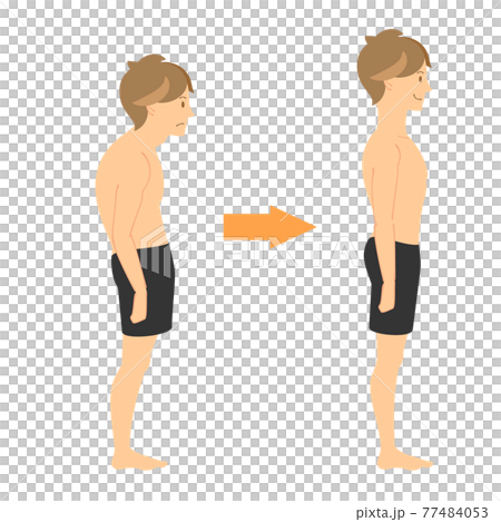 Posture correction before and after - Stock Illustration [77484053] - PIXTA