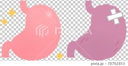 A healthy stomach and a weak stomach - Stock Illustration [78702853 ...