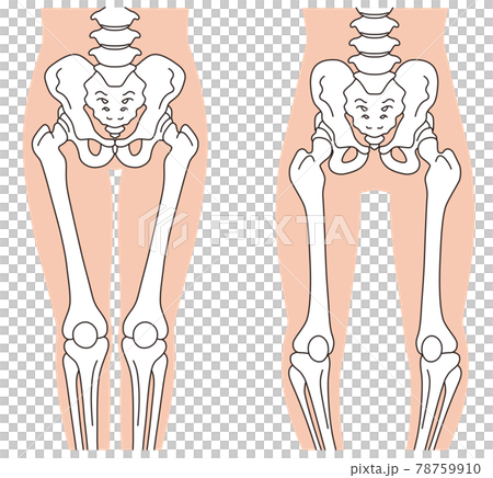 Pelvis and skeleton O-leg skeleton Pelvic... - Stock Illustration ...