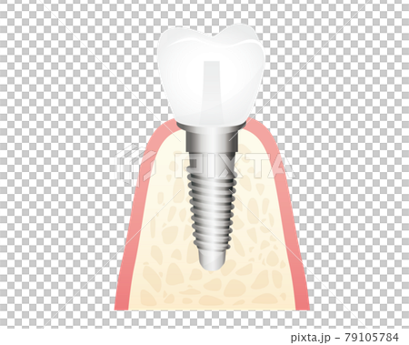 cog, teeth, tine - Stock Illustration [79105784] - PIXTA