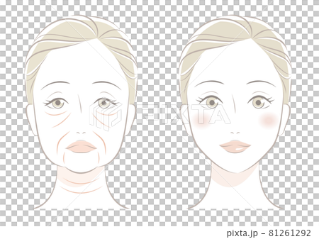 Slack in the face - Stock Illustration [81261292] - PIXTA