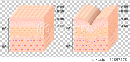 Skin cross section (wrinkles) - Stock Illustration [82897378] - PIXTA