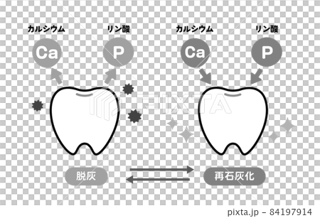 Illustration of teeth on decalcification and... - Stock Illustration ...