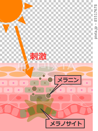 太陽光の刺激を受けて肌トラブルが起こる断面構造のイラスト素材 [85517678] - PIXTA