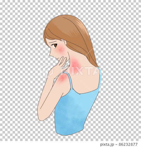 Female with rough skin - Stock Illustration [86232877] - PIXTA