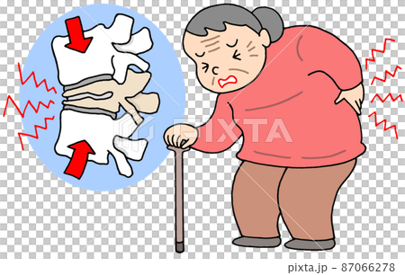 Vertebral compression fracture in the elderly - Stock Illustration ...