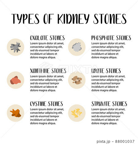 4 Types Of Kidney Stones