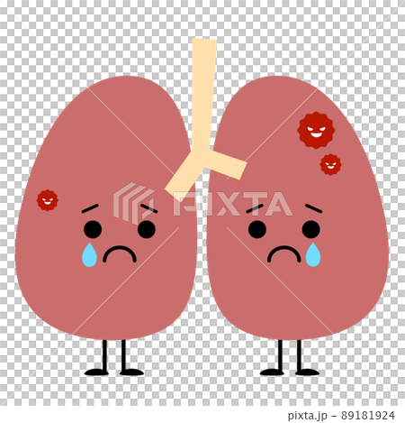 Lungs that are sad because of lung cancer - Stock Illustration ...