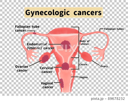 Illustrated illustrations of gynecological... - Stock Illustration ...