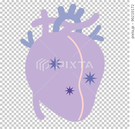 Bacterial infected heart - Stock Illustration [90210172] - PIXTA