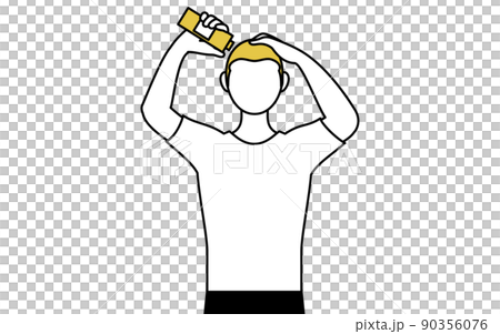 AGA Male pattern baldness, sprinkle hair growth... - Stock Illustration ...