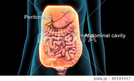 Damaged failed small intestine in human body.のイラスト素材 [90584457] - PIXTA