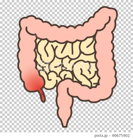 Illustration of the cecum - Stock Illustration [90675902] - PIXTA