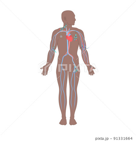 Central line venous catheter types on male bodyのイラスト素材 [91331664] - PIXTA