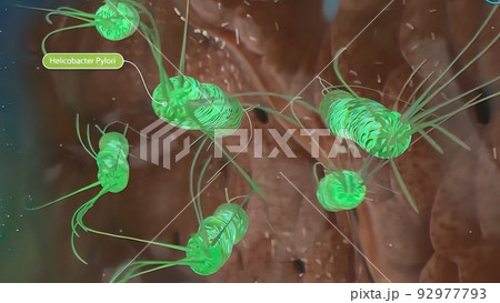 Helicobacter pylori, a gram, microaerophilic...のイラスト素材 [92977793] - PIXTA