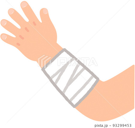 包帯を巻いている腕のイラスト素材 [93299453] - PIXTA