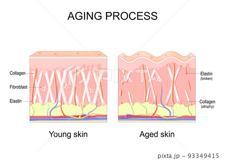 Aging process. comparison of Young and aged...のイラスト素材 [93349415] - PIXTA