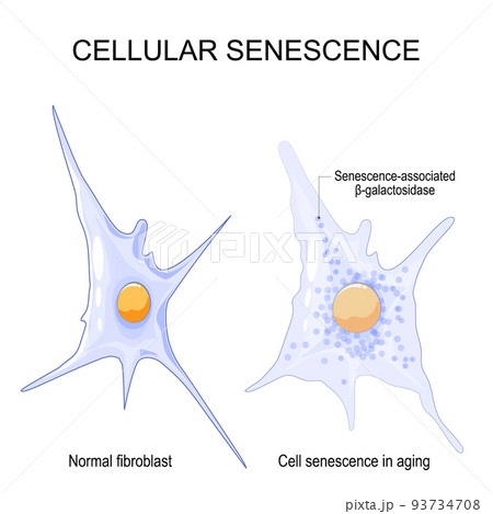 changes senescent cells During ageingのイラスト素材 [93734708] - PIXTA