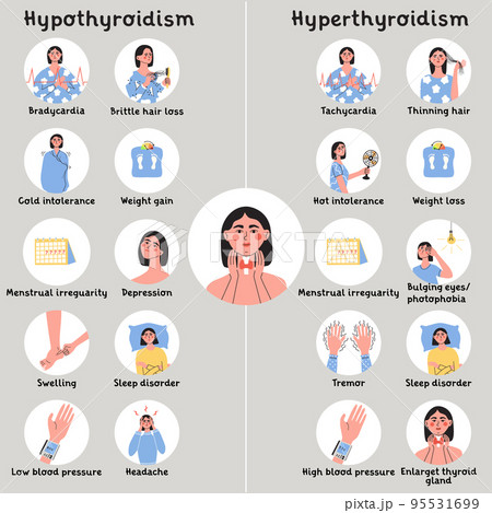Hypothyroidism and hyperthyroidism symptoms....のイラスト素材 [95531699] - PIXTA