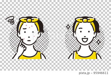Girl with improved acne and rough skin - Stock Illustration [95946611 ...