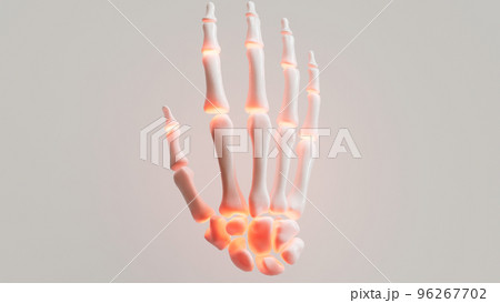 Rheumatoid arthritis on white background - 3D...のイラスト素材 [96267702] - PIXTA